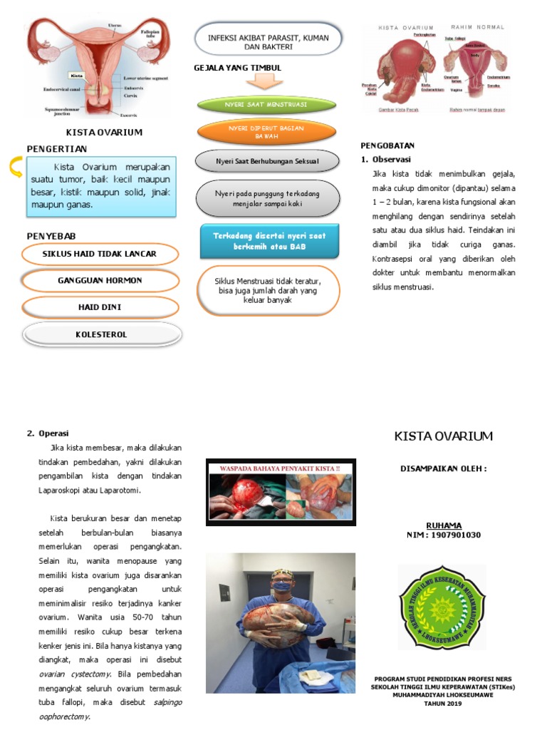Penyebab dan Pengobatan Kista Ovarium | PDF