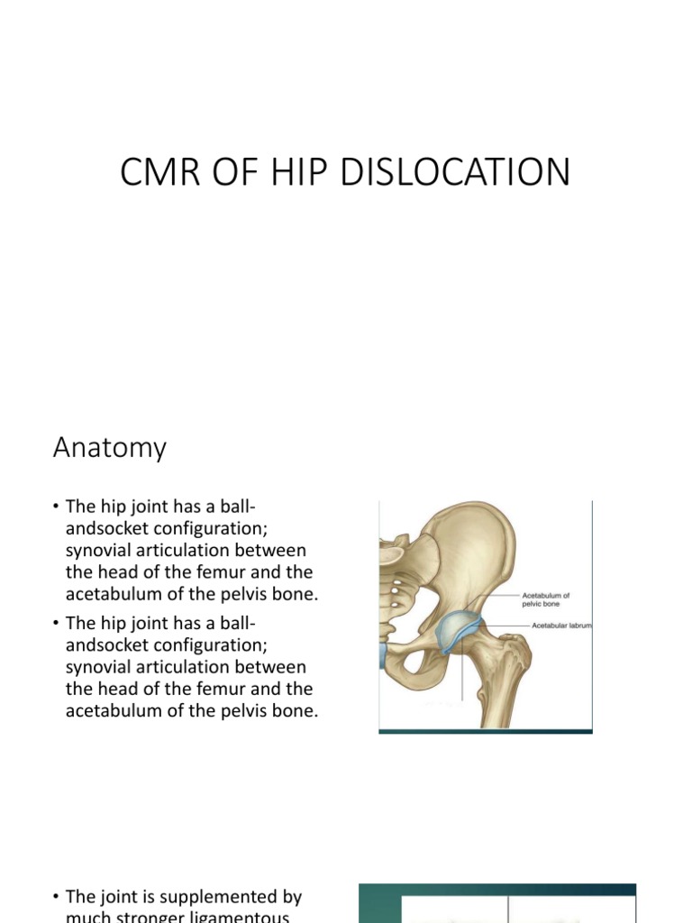 Posterior Hip Dislocation Presentation