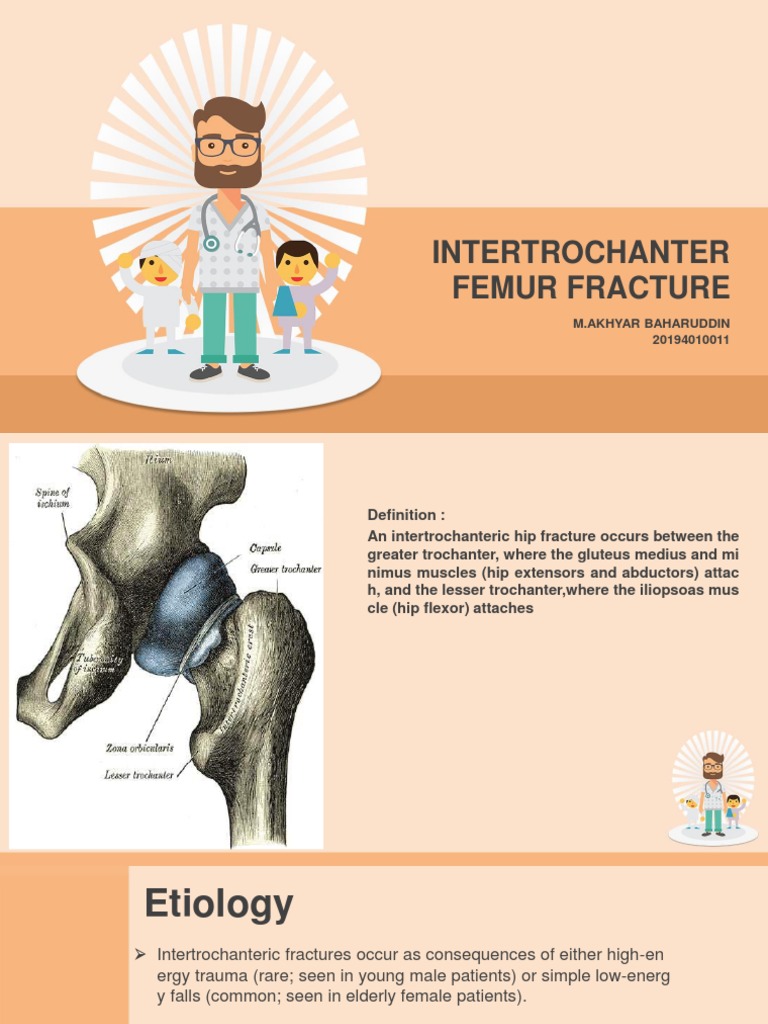 Intertrochanter Femur Fracture: M.Akhyar Baharuddin 20194010011 | PDF ...