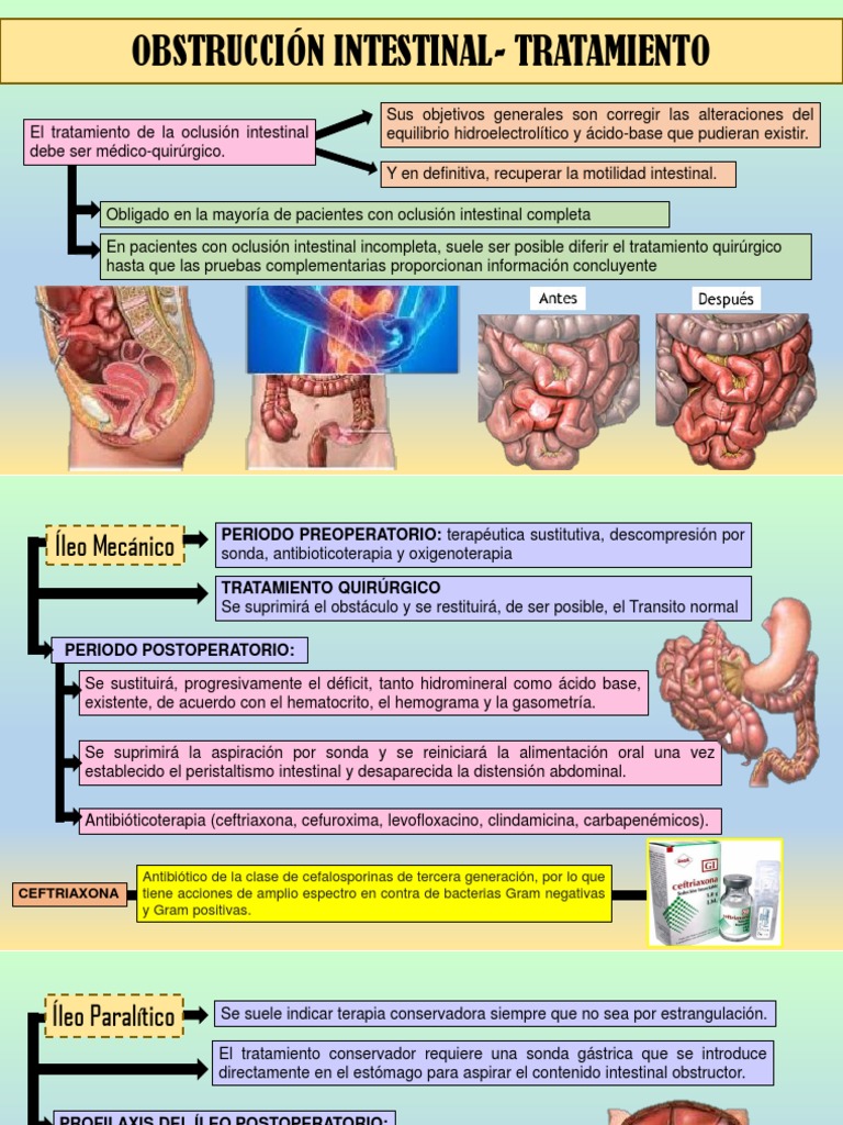 Tratamiento de la Obstrucción Intestinal | PDF | Estómago | Rtt