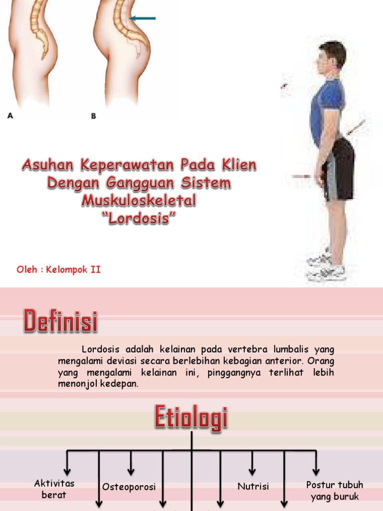 Penanganan dan Ciri Lordosis | PDF | Pengembangan Diri | Sains & Matematika