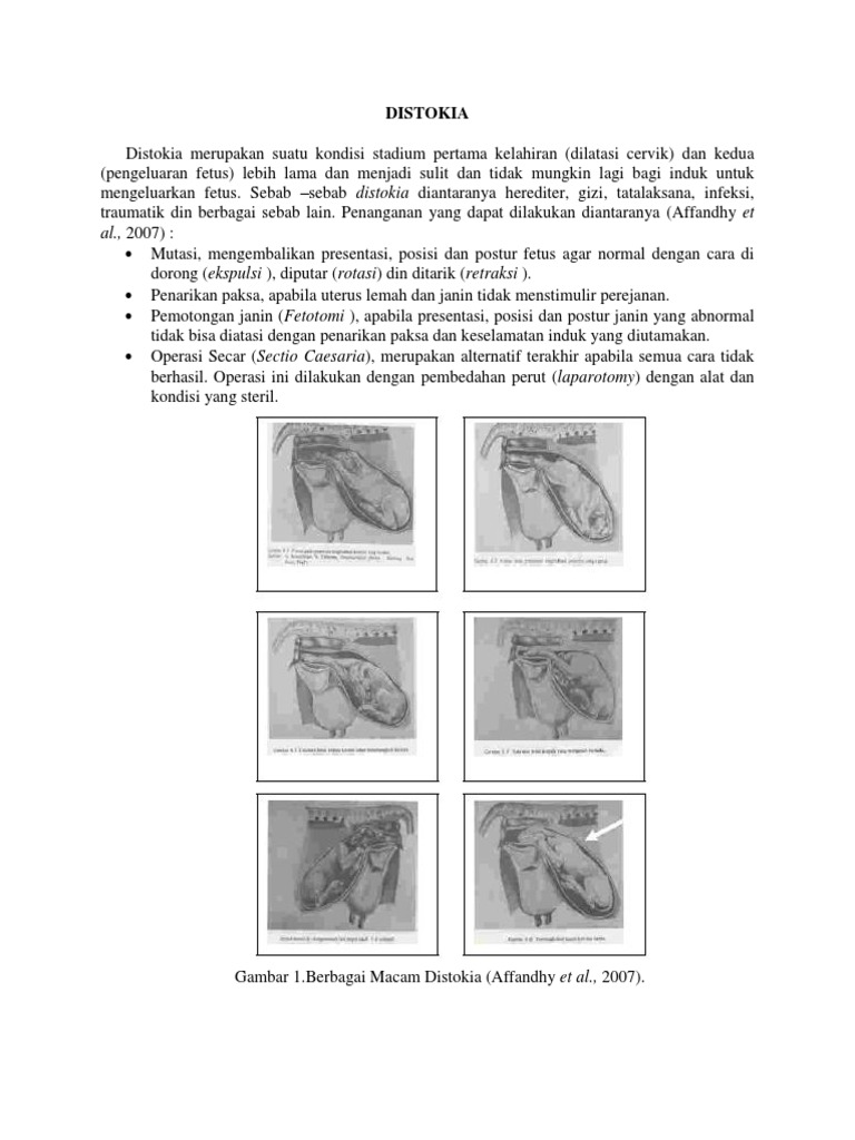 Penanganan Distokia | PDF