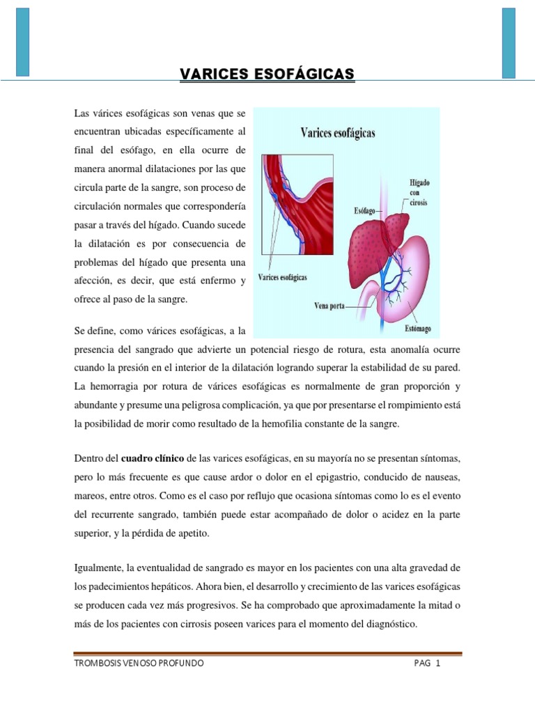 Varices Esofagica | PDF | Venas varicosas | Cirrosis