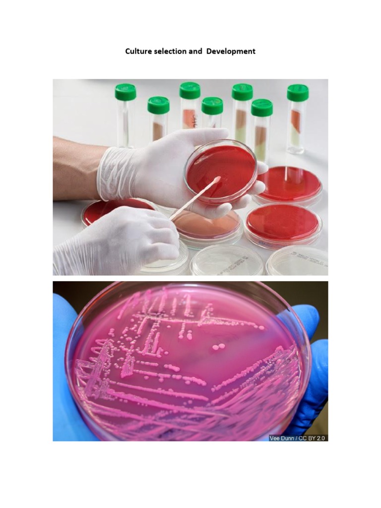 Culture Selection and Development | PDF