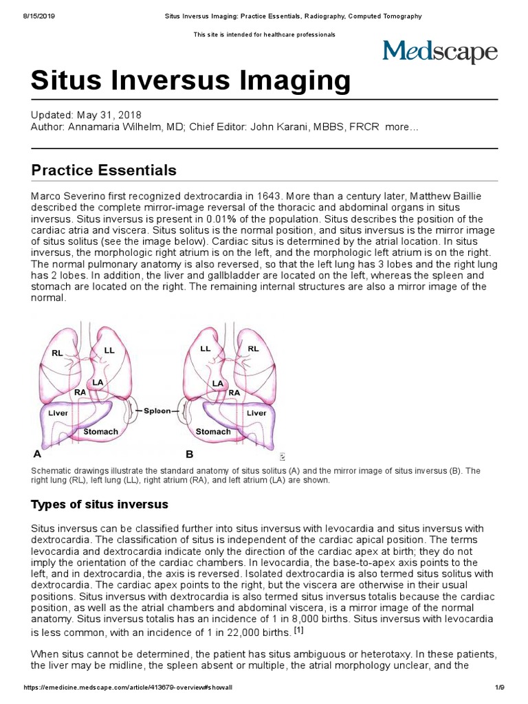 Situs Inversus Imaging - Practice Essentials, Radiography, Computed ...