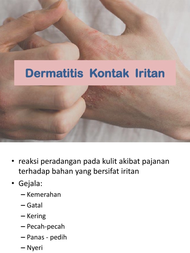 Gejala dan Pencegahan Dermatitis Kontak | PDF