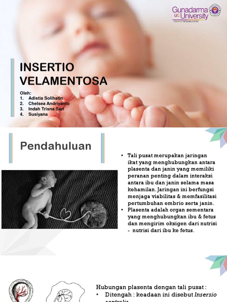 Insertio Velamentosa | PDF