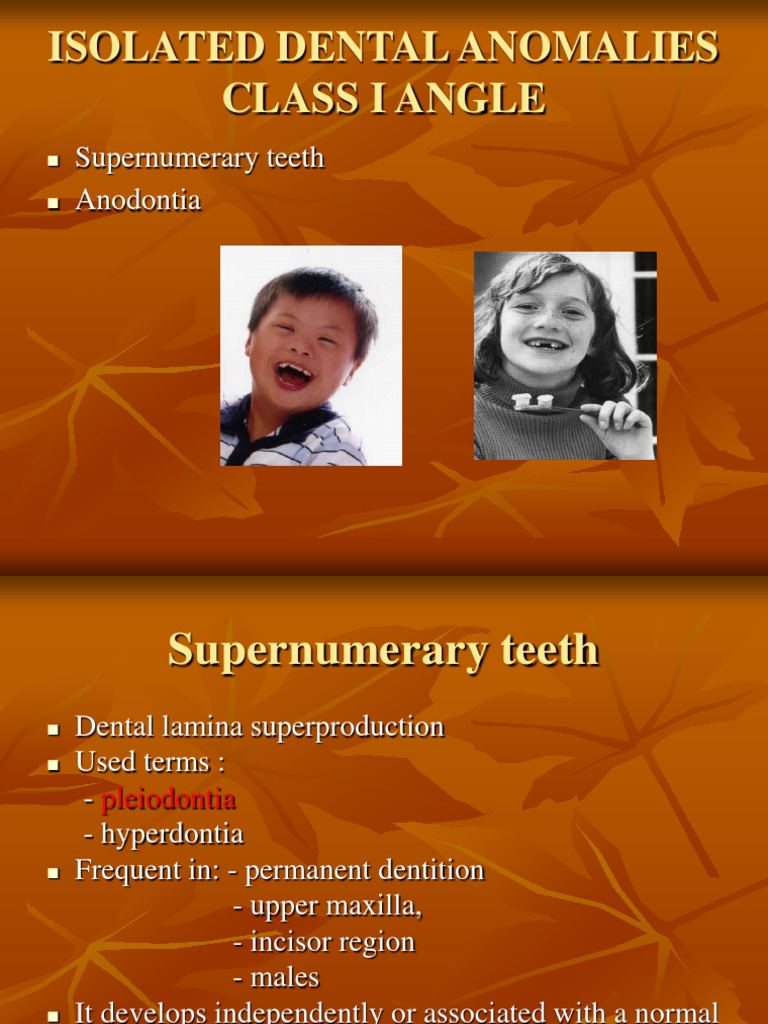 Isolated Dental Anomalies Class I Angle: Supernumerary Teeth Anodontia ...