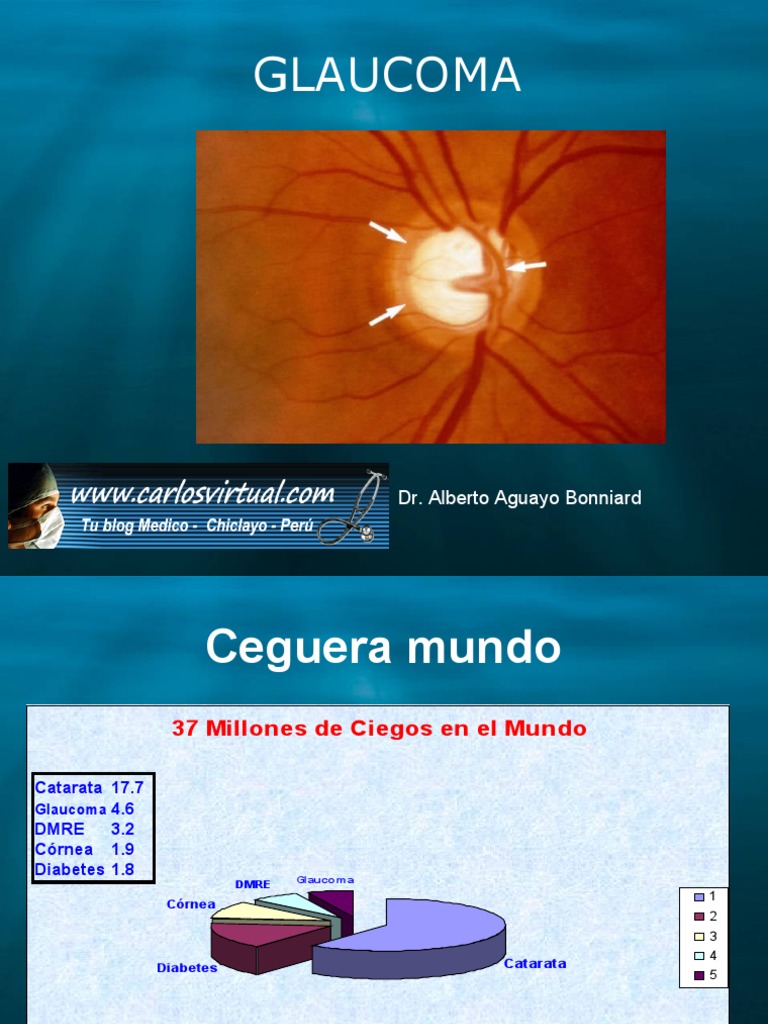 Glaucoma | Descargar gratis PDF | Glaucoma | Ojo humano