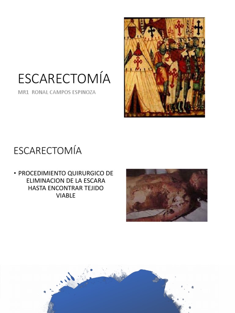 ESCAROTOMÍA | PDF | Quemar | Hospital