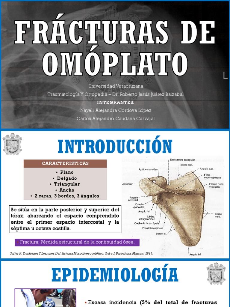 Frácturas de Omóplato | PDF | Hombro | Lesión
