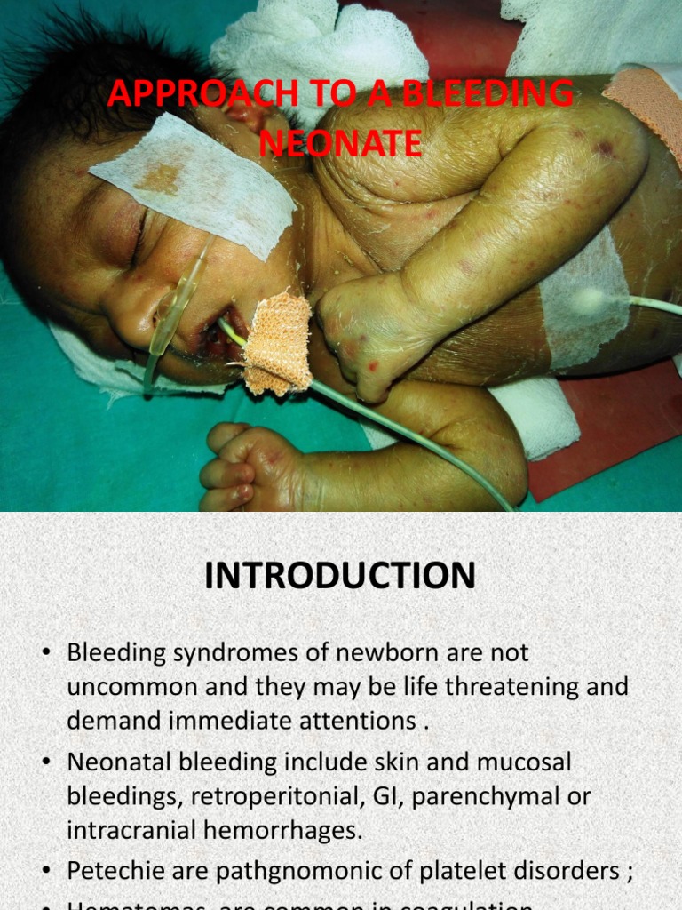 Approach To Bleeding Neonate | PDF | Coagulation | Platelet