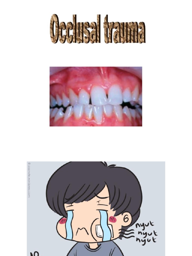 Trauma Oklusi Indo | PDF