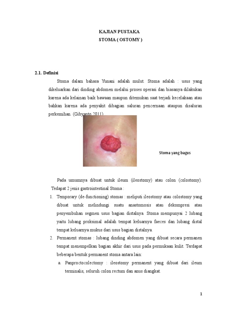 Stoma | PDF
