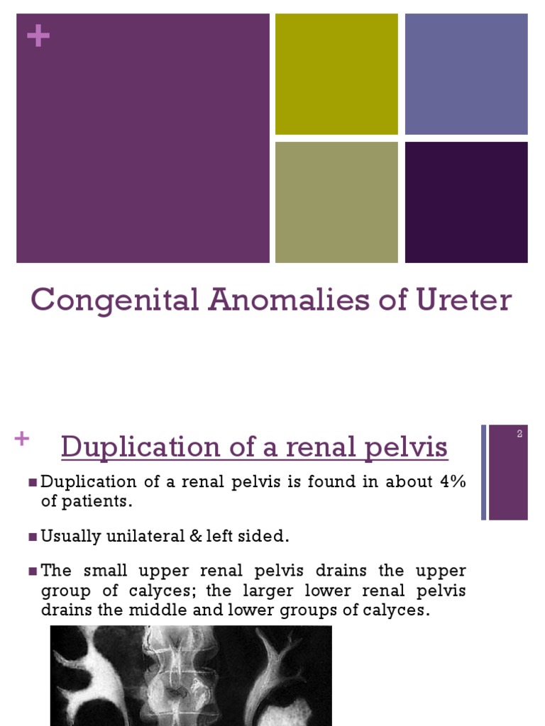 Congenital Anomalies of Ureter Bladder | PDF | Urinary Bladder | Kidney