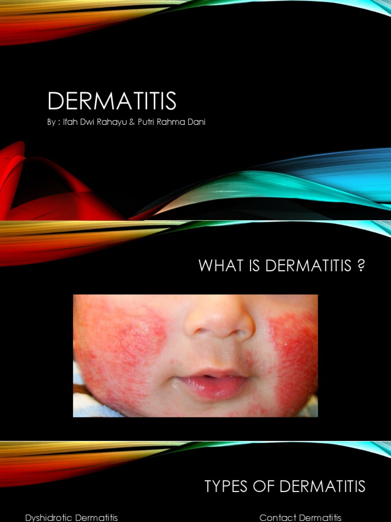 Dermatitis: By: Ifah Dwi Rahayu & Putri Rahma Dani | PDF