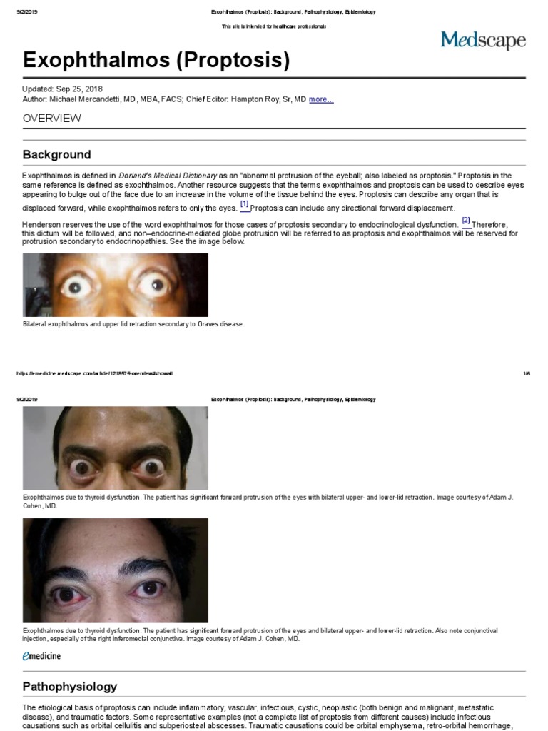 Exophthalmos (Proptosis) - Background, Pathophysiology, Epidemiology ...