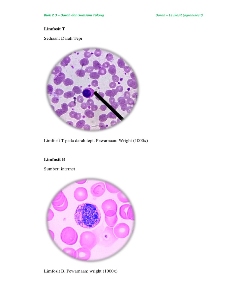 Leukosit (Agranulosit) | PDF