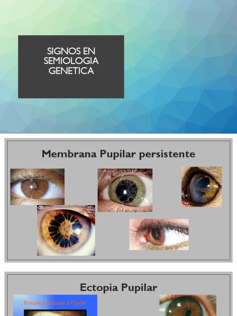 Signos en Semiologia Genetica | PDF | Salud y bienestar | Ciencia y ...