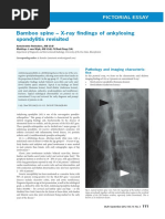 Winking Owl and Bamboo Spine Signs | PDF | Vertebral Column | Spinal Cord