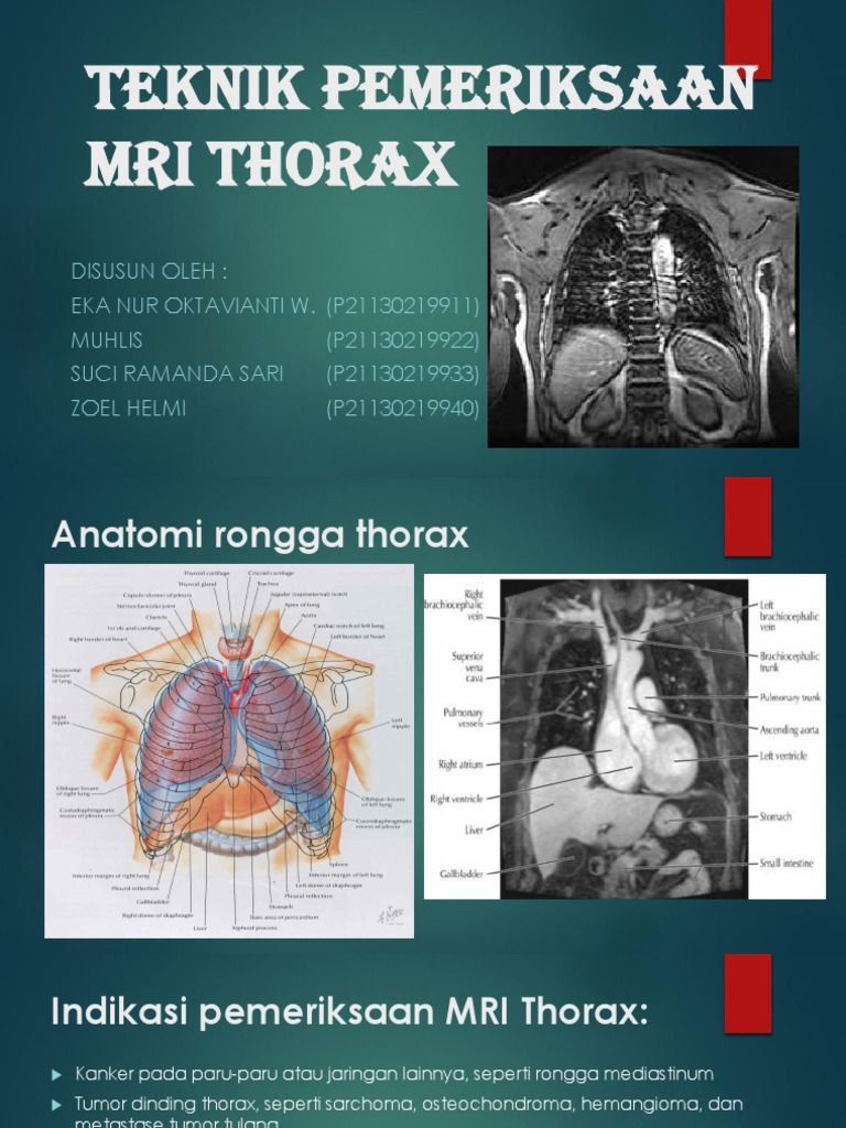 MRI Thorax | PDF | Kesehatan Holistik | Sains & Matematika