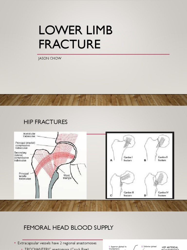 Lower Limb Fracture Management Overview | PDF | Musculoskeletal System ...