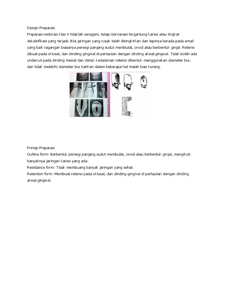 PRINSIP-PRINSIP PREPARASI RESTORASI KLAS V | PDF