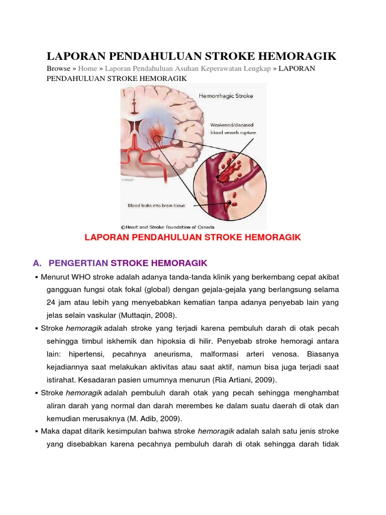 Laporan Pendahuluan Stroke Hemoragik | PDF
