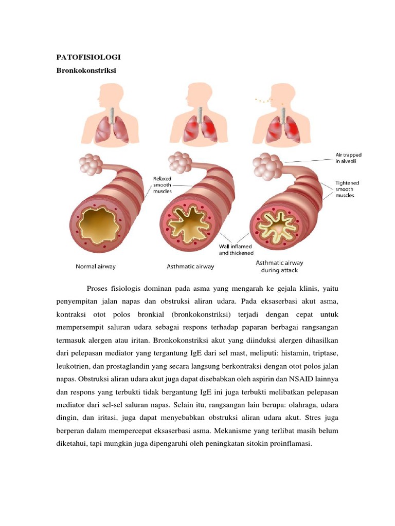 Patofisiologi dan Mekanisme Asma | PDF