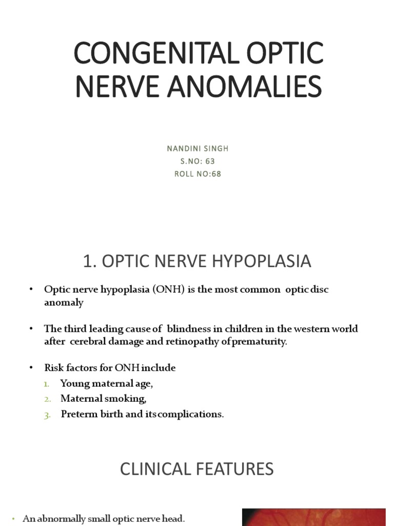 Congenital Optic Nerve Anomalies: Nandini Singh S.NO: 63 Roll No:68 ...