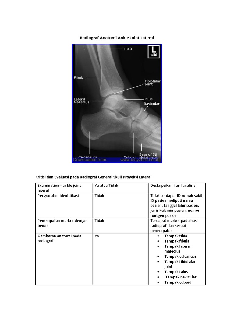 Radiograf Anatomi Ankle Joint Lateral | PDF