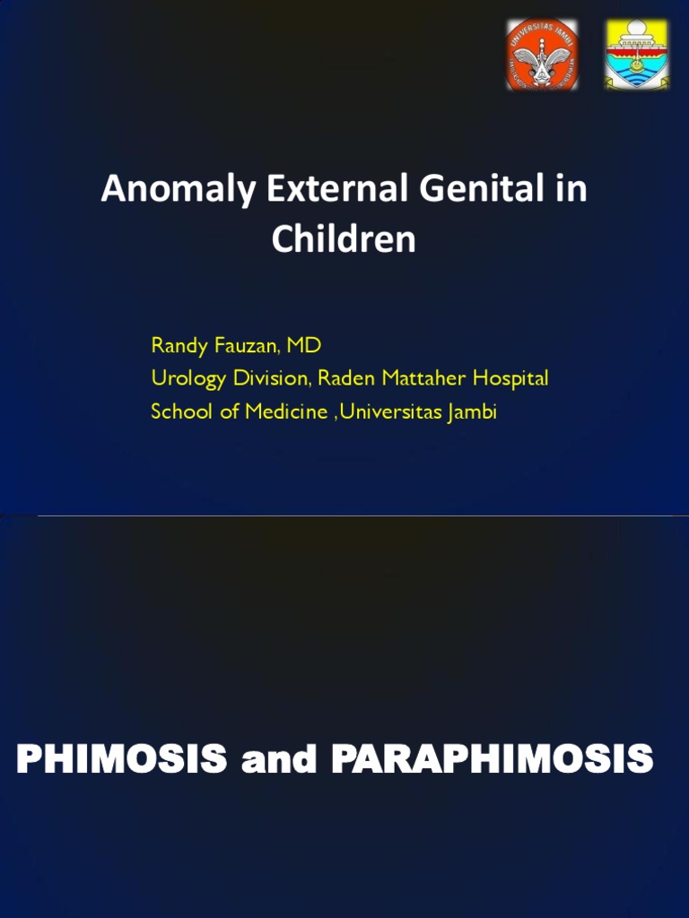 Pediatric Genital Anomalies Overview | PDF | Mammal Reproductive System ...
