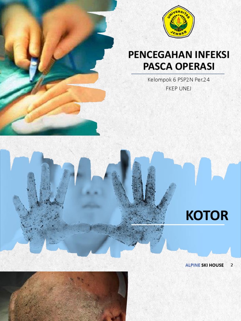 Pencegahan Infeksi Pasca Operasi | PDF