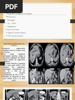 Protocolo UROTAC | PDF