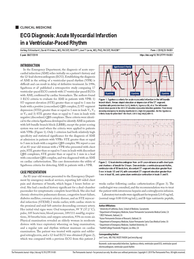 ECG Diagnosis: Acute Myocardial Infarction in A Ventricular-Paced ...