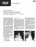 Ejemplo RX Torax Normal | PDF