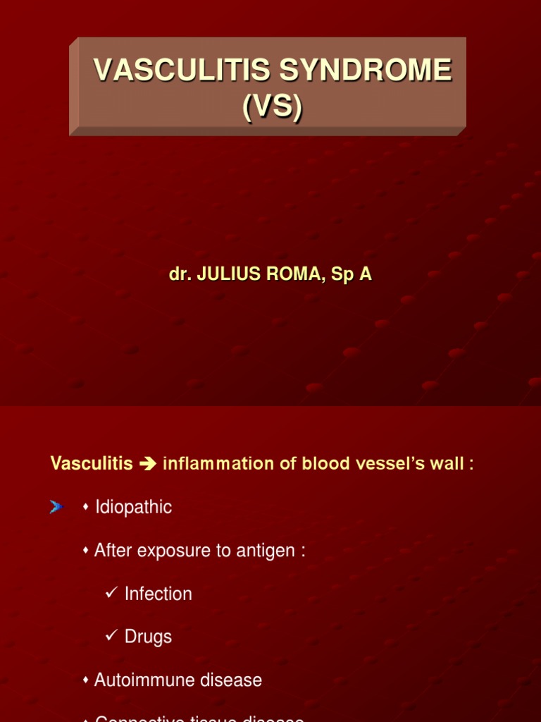 An Overview of Vasculitis Syndromes: Classification, Etiology, Clinical ...