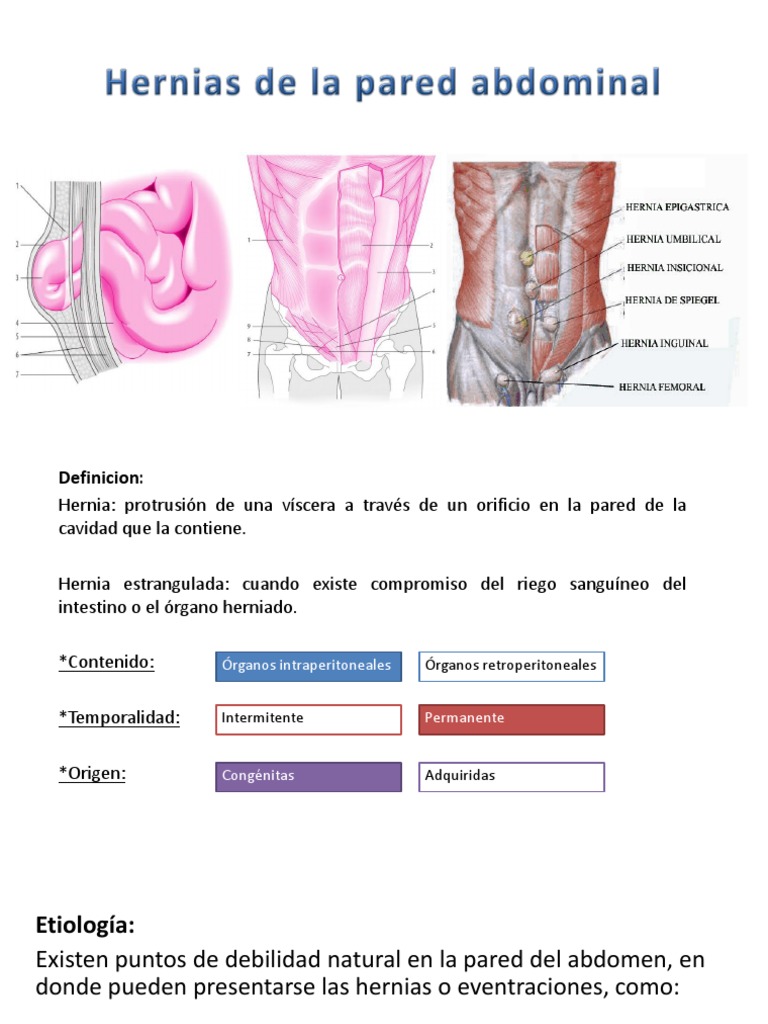 Hernias de La Pared Abdominal | PDF | Abdomen | Medicina