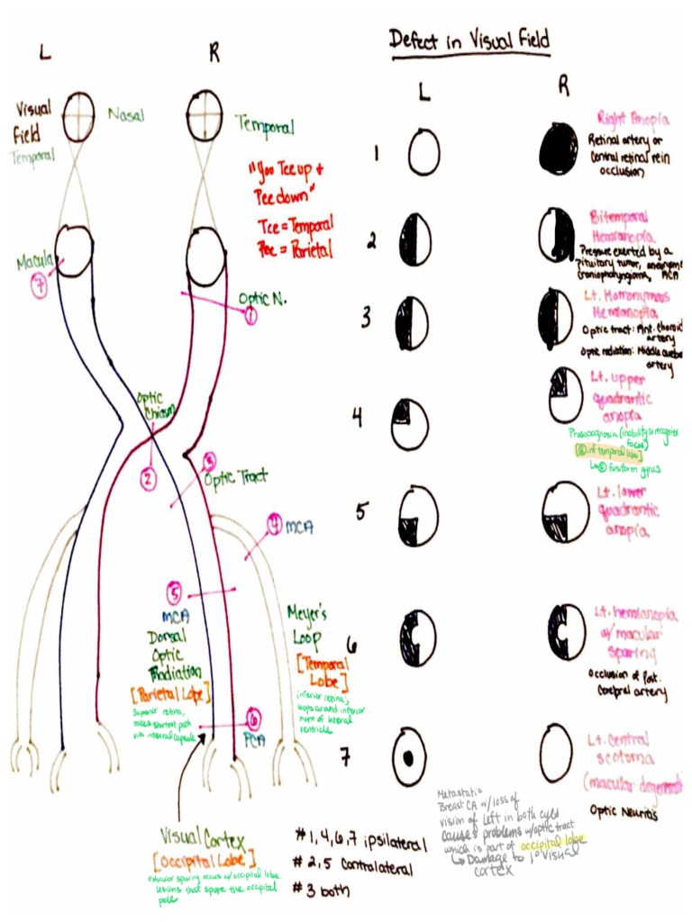 Visual Field Defects | PDF