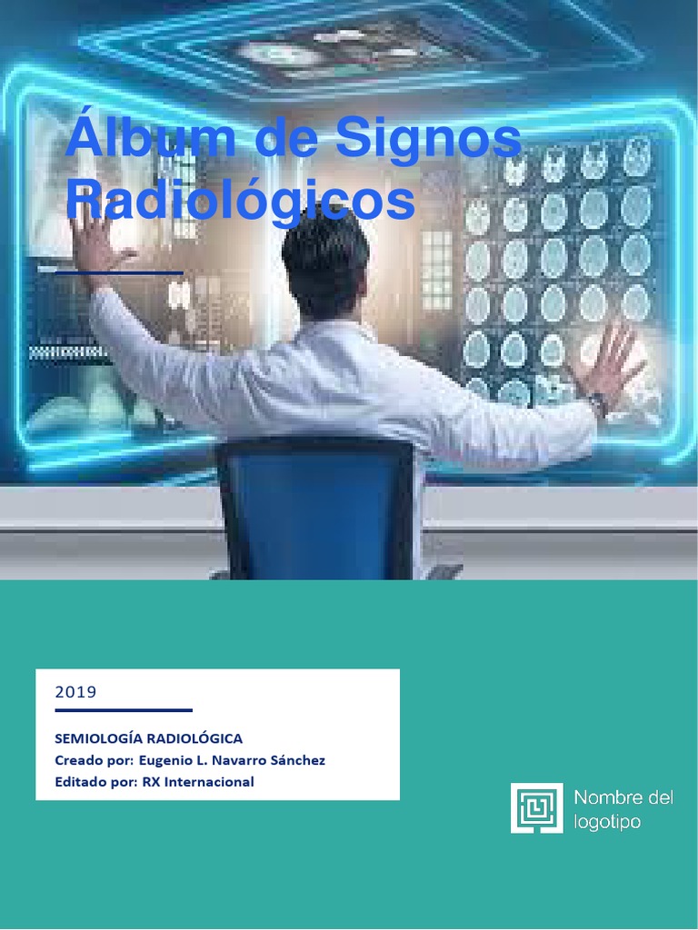 Álbum de Signos Radiológicos - Semiología Radiológica.pdf | Infarto de ...