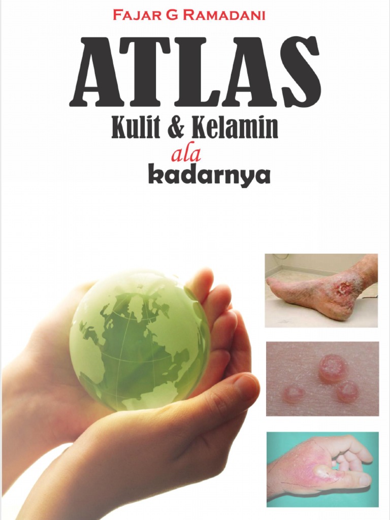 ATLAS Kulit and Kelamin Ala Kadarnya PDF | PDF