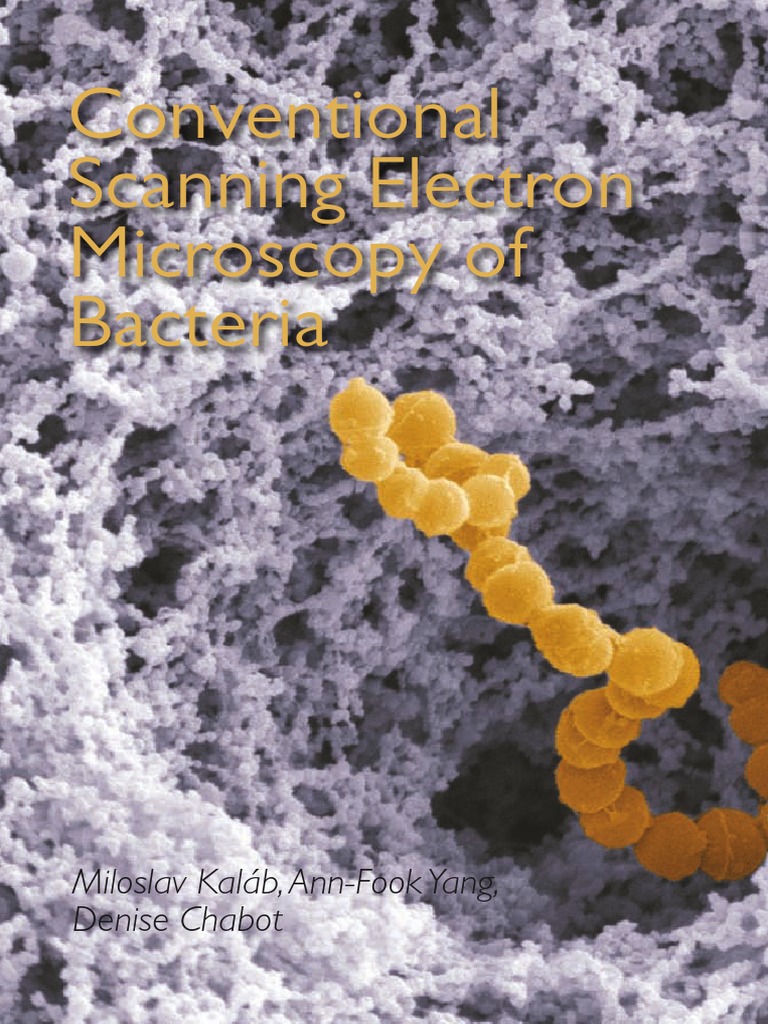 Sem PDF | Download Free PDF | Scanning Electron Microscope | Bacteria