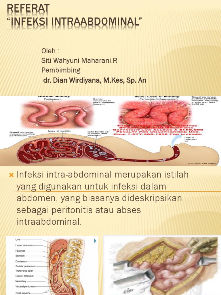 Infeksi Intraabdominal | PDF