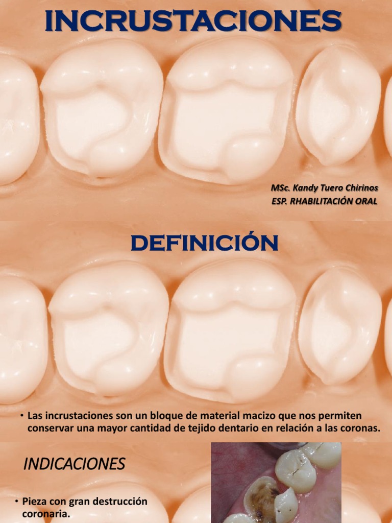 INCRUSTACIONES | PDF | Materiales | Naturaleza