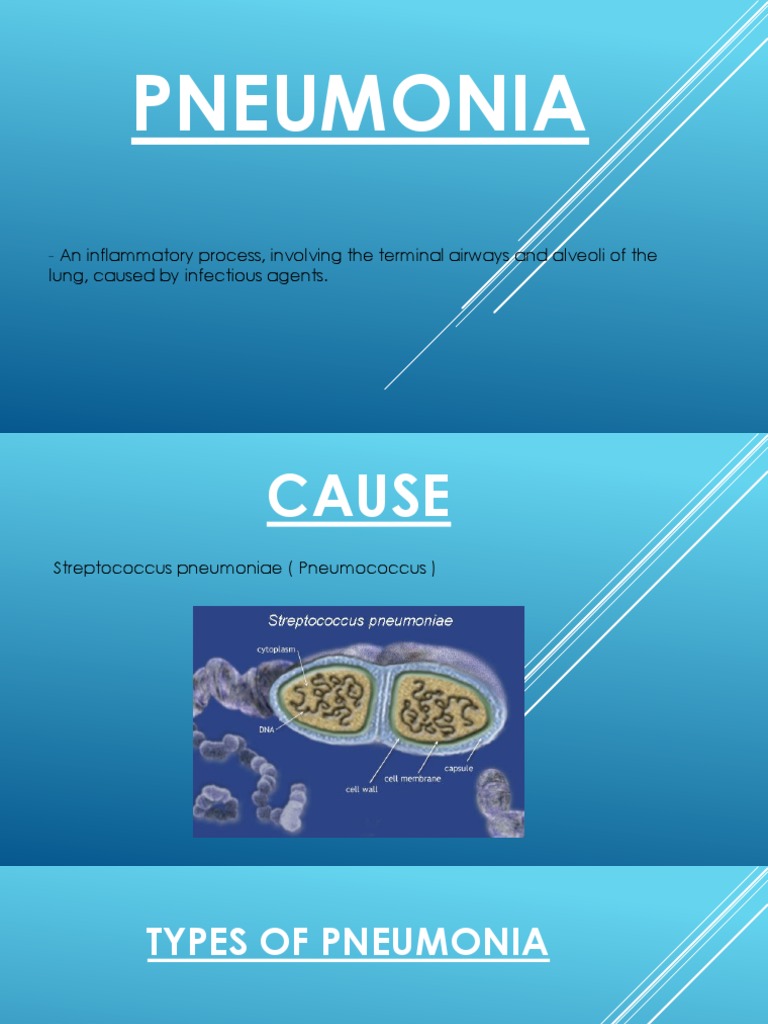 Pneumonia: An Inflammatory Process, Involving The Terminal Airways and ...