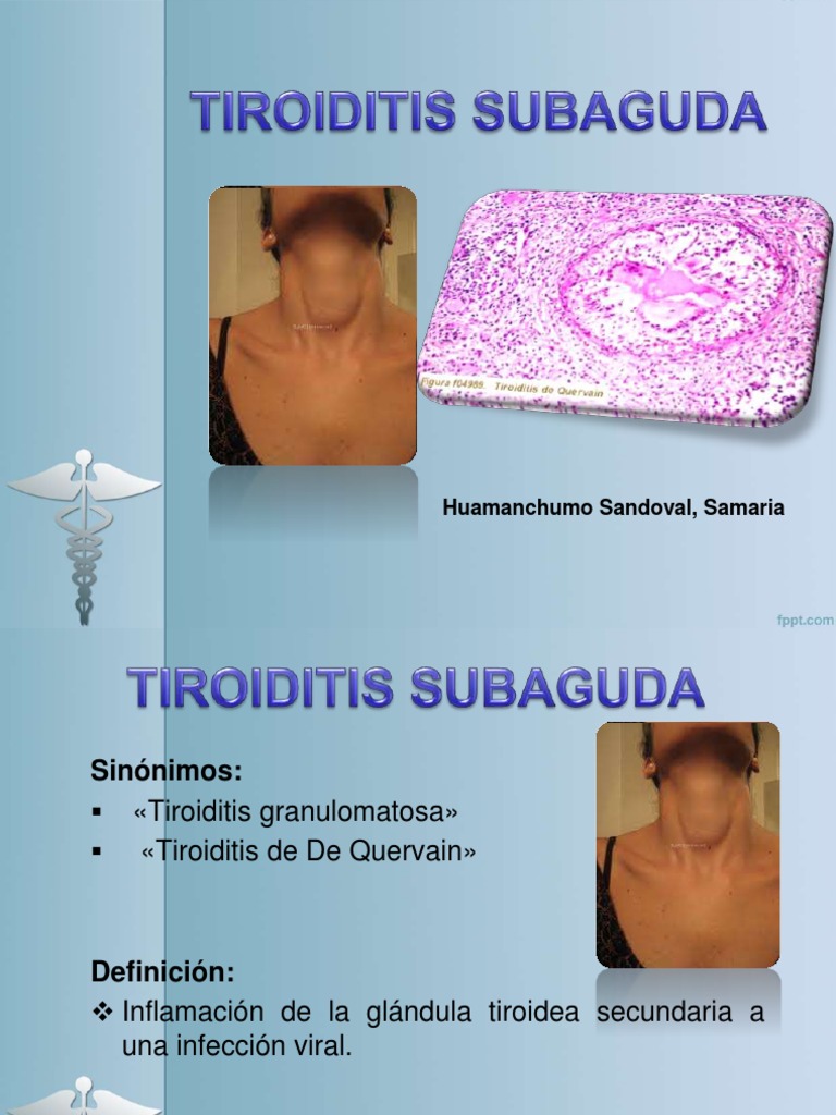 Tiroiditis | PDF | Tiroides | Hormona estimulante de la tiroides