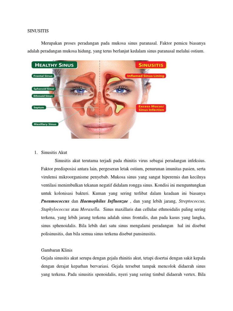 SINUSITIS | PDF