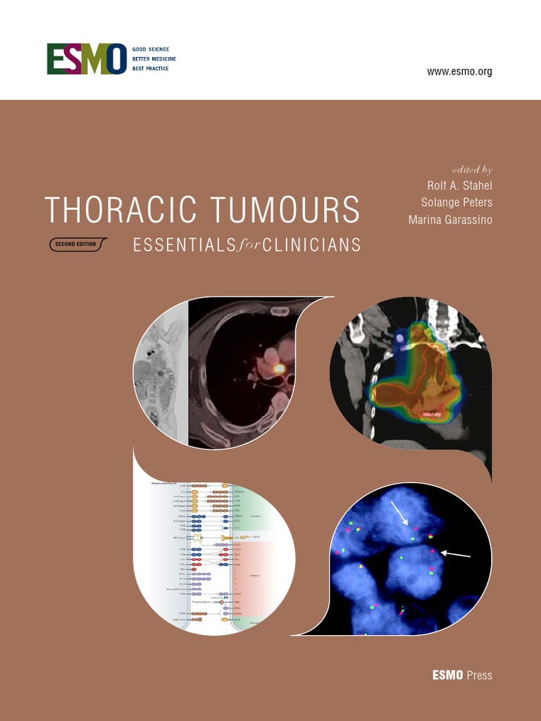 ESMO Essentials Clinicians Thoracic Tumours 2019 PDF | PDF | Lung ...