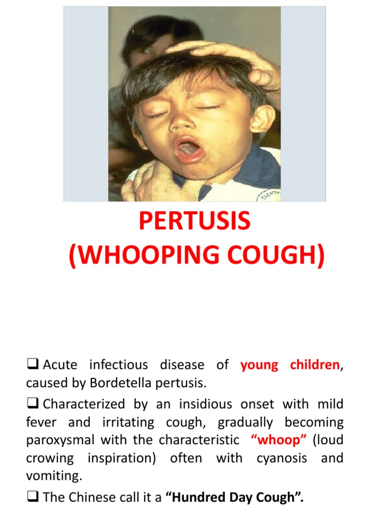Pertusis 2 | PDF | Epidemiology | Pediatrics