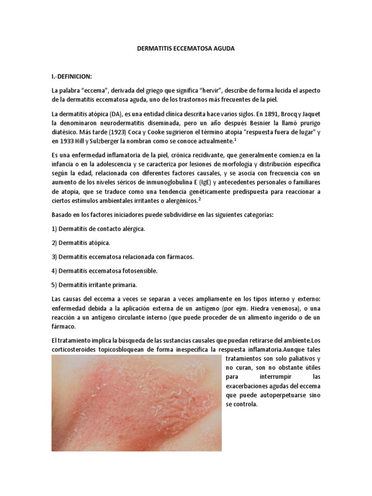 Dermatitis Eccematosa Aguda: Definición y Tratamiento | PDF | Citocina ...